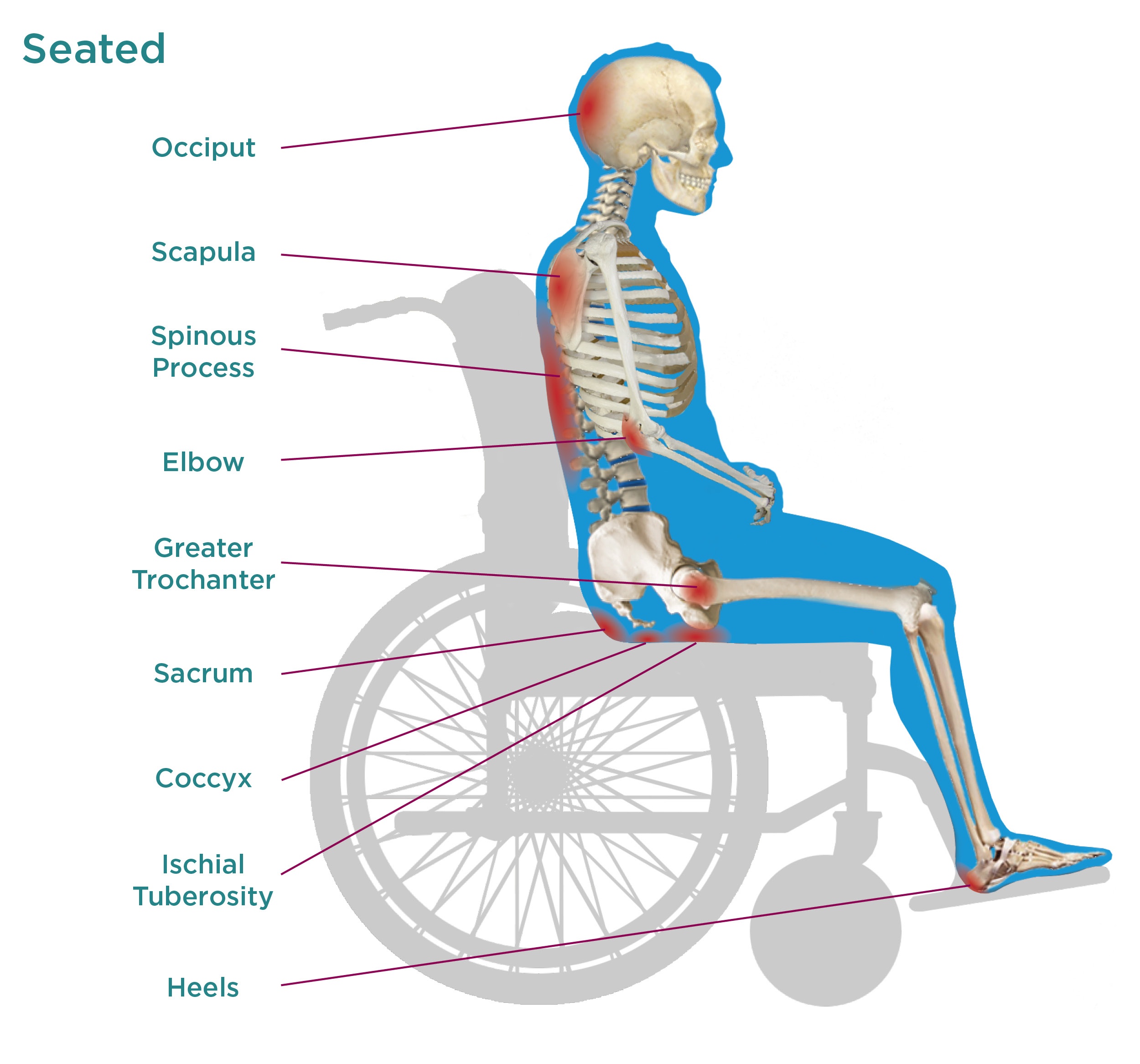 Wound Care Guide Wound Care Guide